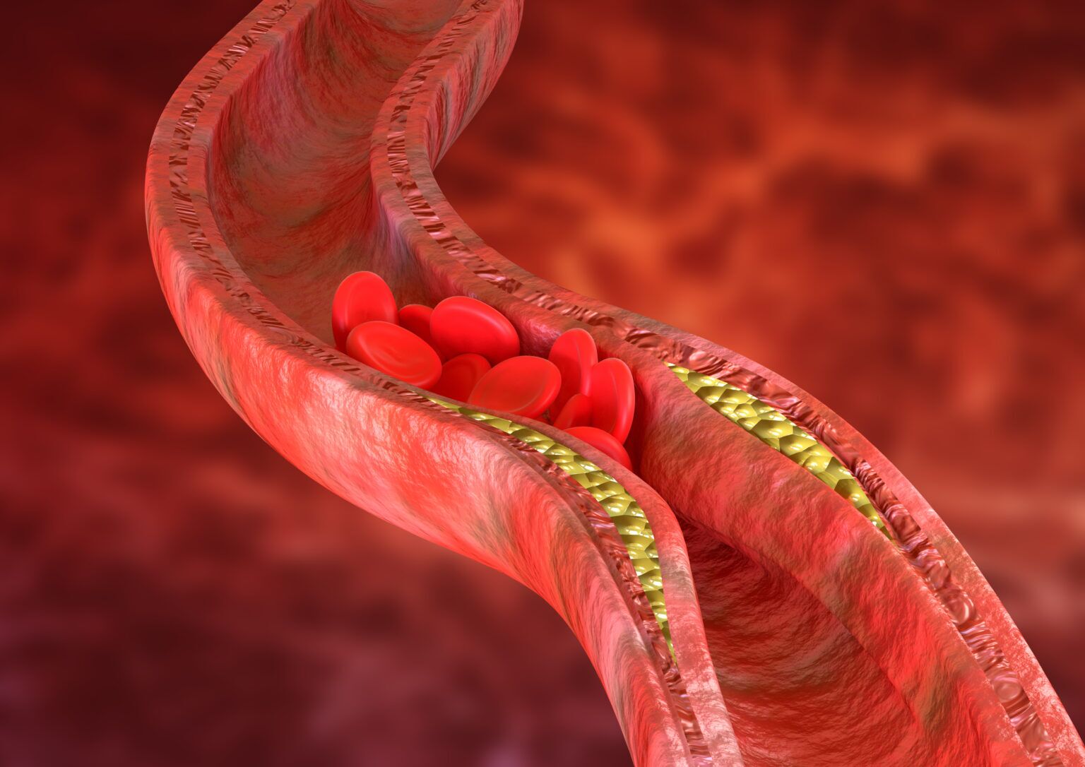 Treating Cardiovascular Disease with Functional Medicine | COCFM